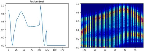 Github Samerkharboush Ecg Overview The Ecg Heartbeat Classification