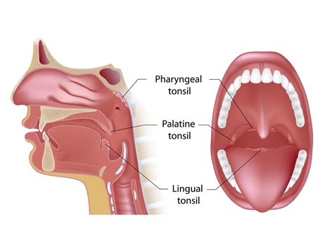 White Tongue And White Spots On Tonsils
