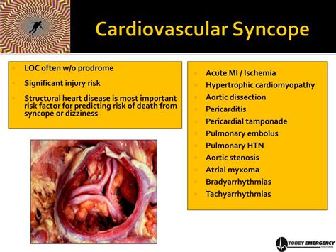 Ppt Syncope Dizziness And Vertigo Case Review Powerpoint Presentation Id2085587