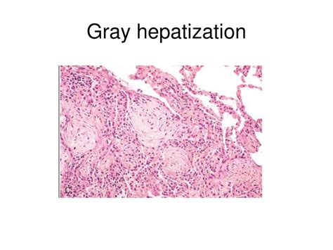 Ppt Respiratory System Powerpoint Presentation Free Download Id