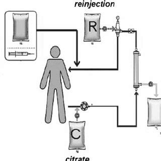 Schema Of The Citrate Continuous Venovenous Hemofiltration CVVH Download Scientific Diagram