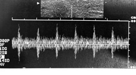 Physics Artifacts Flashcards Quizlet
