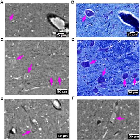 Frontiers Protocol For 3d Virtual Histology Of Unstained Human Brain Tissue Using Synchrotron