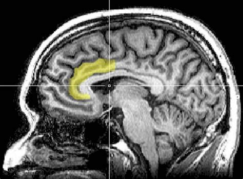 Subgenual Anterior Cingulate Cortex News Research Tags Articles Neuroscience News