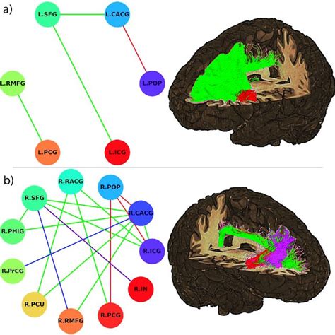 Schematic Illustration Of The Pipeline Used To Obtain The Connectivity