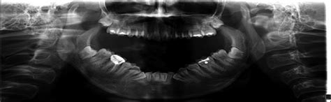 Annals Of Maxillofacial Surgery