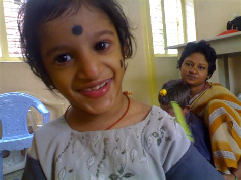 Physio And Health Congenital Dwarfism