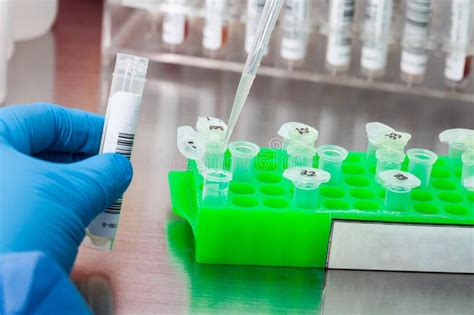 Closeup Of A Scientist Extracting Dna Using The Spin Column Based Nucleic Acid Purification