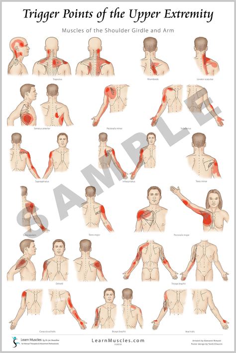 Counterstrain Points Chart Counterstrain Points