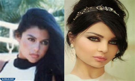 هيفاء وهبي قبل وبعد موقع المرجع