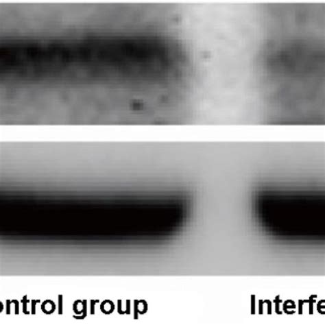 Transcriptome Sequencing Heat Map In Control Group And Interference