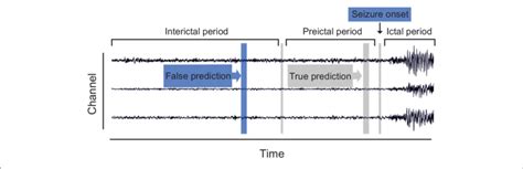 Definition Of Three Brain States In Continuous Epileptic EEG