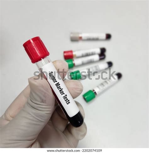 Early Detection Cancer Images Stock Photos Vectors Shutterstock