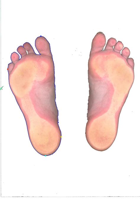 Remove Background Of Scanned Foot Python Opencv