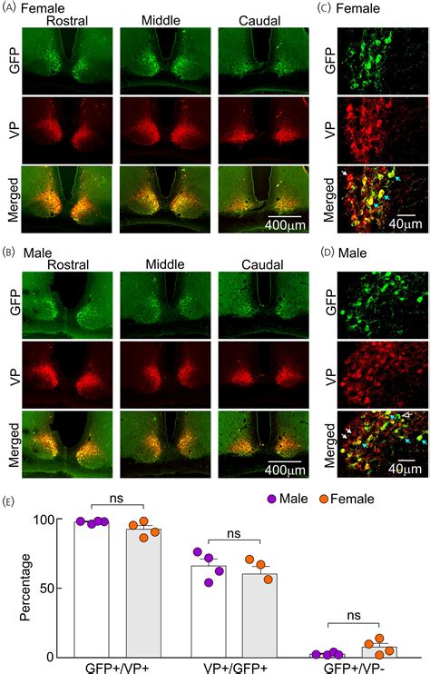Sex‐specific Differences In The Circadian Pattern Of Action Potential