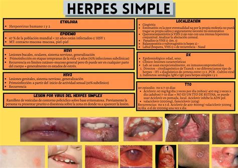 Herpes Simple Karine Bacellar Udocz