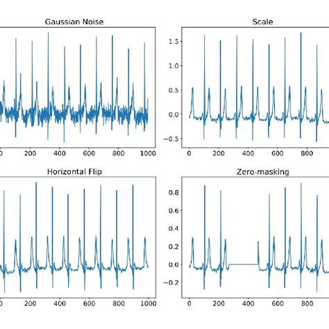 Different Augmentations Applied On A Sample Ecg Segment Download