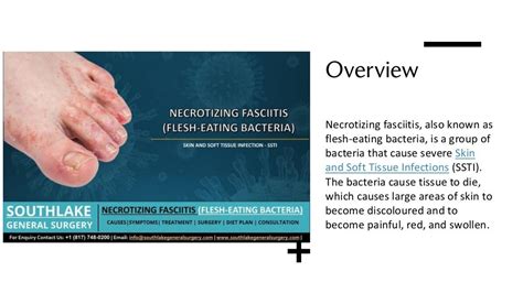 Necrotizing Fasciitis Flesh Eating Bacteria Ssti Pdf
