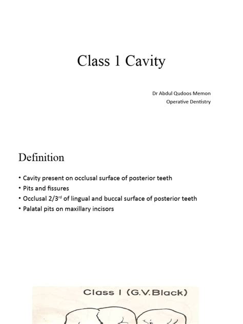 Class 1 Cavity 1 Pdf