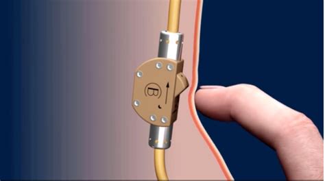 New Male Birth Control ‘sperm Switch Temporaily Sterilizes Men With The Flip Of A Switch