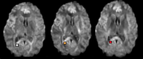 Calculate The Diffusion Tensor From Diffusion Weighted Images A