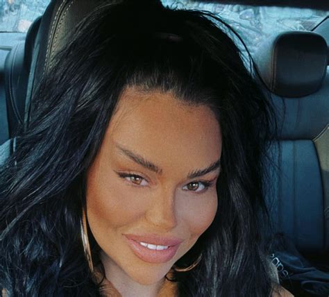 Nema Mi Smrti Bez Malja Zerina Hećo Zabrinula Porukom O Zdravstvenom