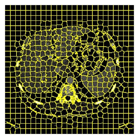 Illustration Of Superpixel Generation A Original Image B Download Scientific Diagram