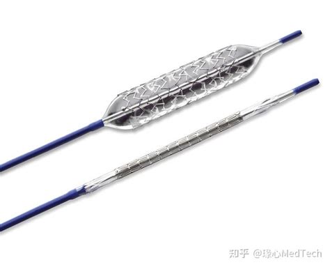 血管支架概况 知乎