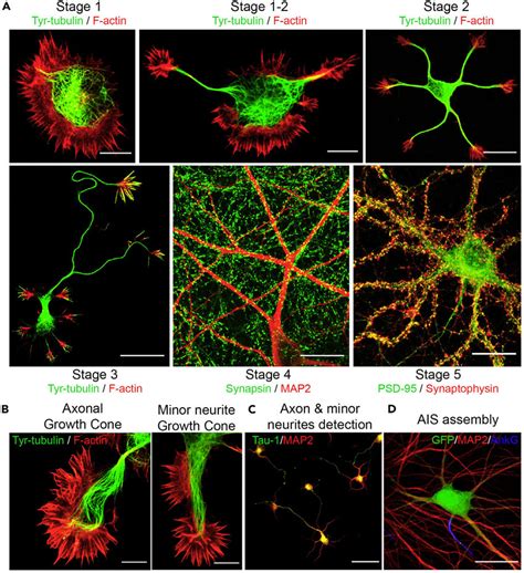 Morphological Stages And Molecular Markers Visualized During The Download Scientific Diagram