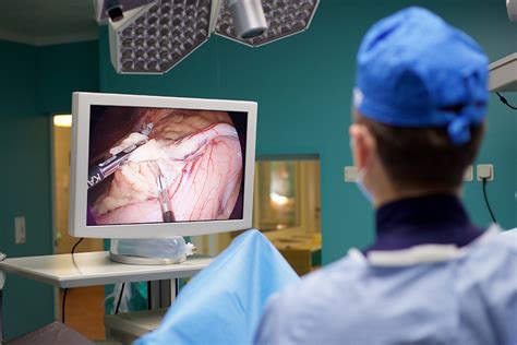 Routine Or Selective Cholangiography During Gallstone Surgery