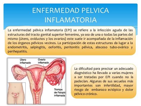 Laparoscopia De Doenca Inflamatoria Pelvica