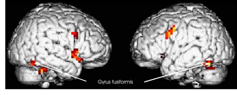 Figure 5 From The Role Of Ventral Premotor Cortex In Action Execution