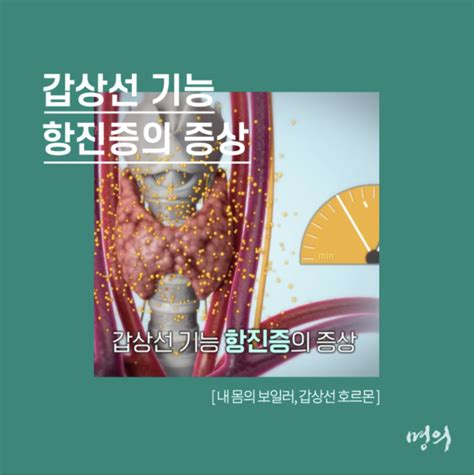 대전 갑상선 기능 항진증에 대해 알아보겠습니다 A21