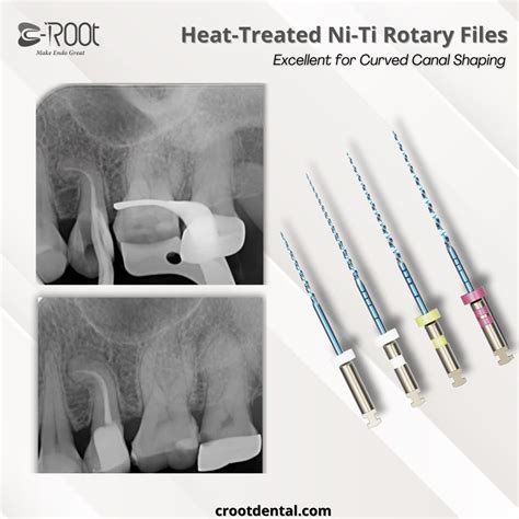 C Root Heat Treated Rotary Ni Ti Files C Root Dental Medical