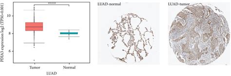 Expression Of Pdia3 In Tumor Tissues And Normal Tissues Of Different
