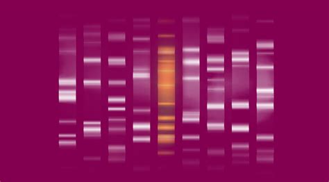 Precision Medicine In Oncology Accelerating Biomarker Testing To Help Advance Patient Outcomes