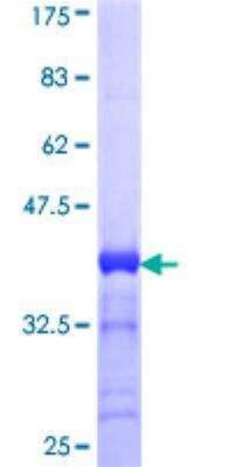 Novus Biologicals Recombinant Human Cacna1s Gst N Term Protein 25 μg Buy Online Novus