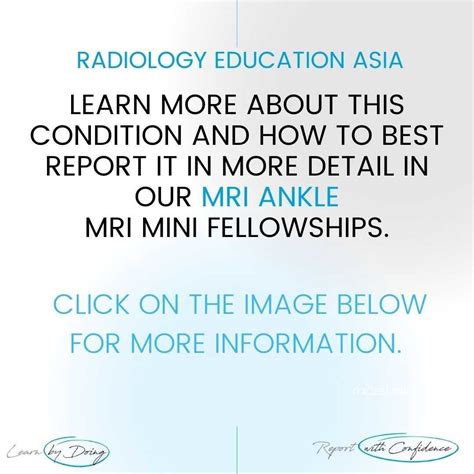 Ankle Synovitis Mri Radiology Radiology Education Asia