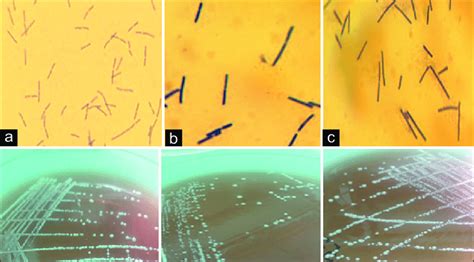 Lactobacillus Casei Colony Morphology A Typical Colony