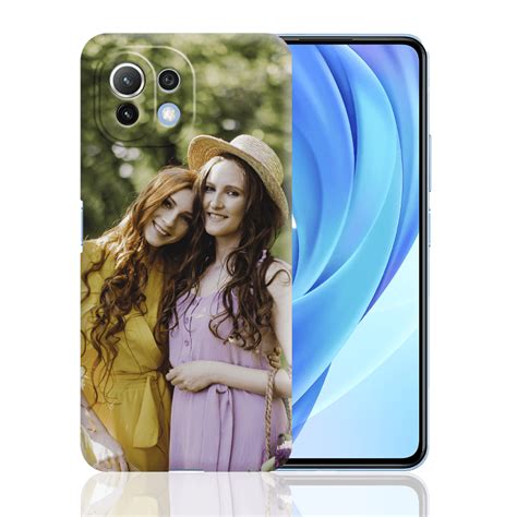 Custom Xiaomi Cases Personalizzalo