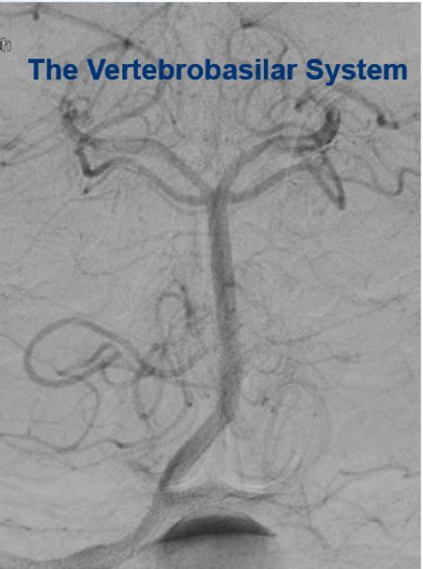 Neuro Ir Diagram Quizlet