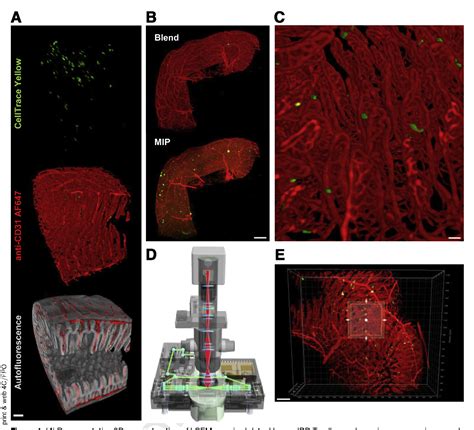 Figure 1 From Three Dimensional Cross Sectional Light Sheet Microscopy Imaging Of The Inflamed