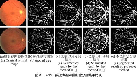 Figure 1 From Retinal Vessel Segmentation Based On Conditional Deep