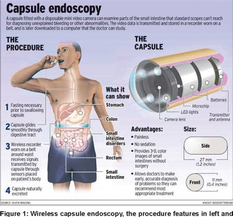 Figure 1 From A New Smart Cmos Image Sensor With On Chip Neuro Fuzzy Bleeding Detection System