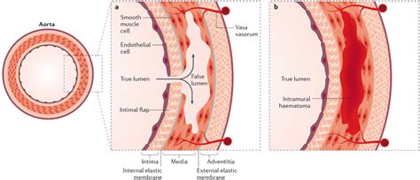 Aorta Anatomy Layers