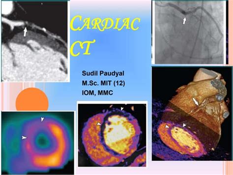 Post Processing Of Computed Tomography Pptx