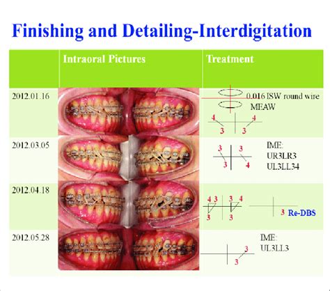 Process Of Finishing And Detailing Interdigitation Download