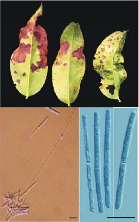 A Cylindrocladium Pteridis Leaf Spot On Socoró Eugenia Brachypoda