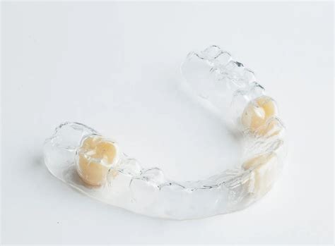 Clear Essix Pontic Retainer Direct Dental Prosthetics