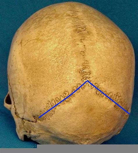 Flickriver Most Interesting Photos Tagged With Lambdoid